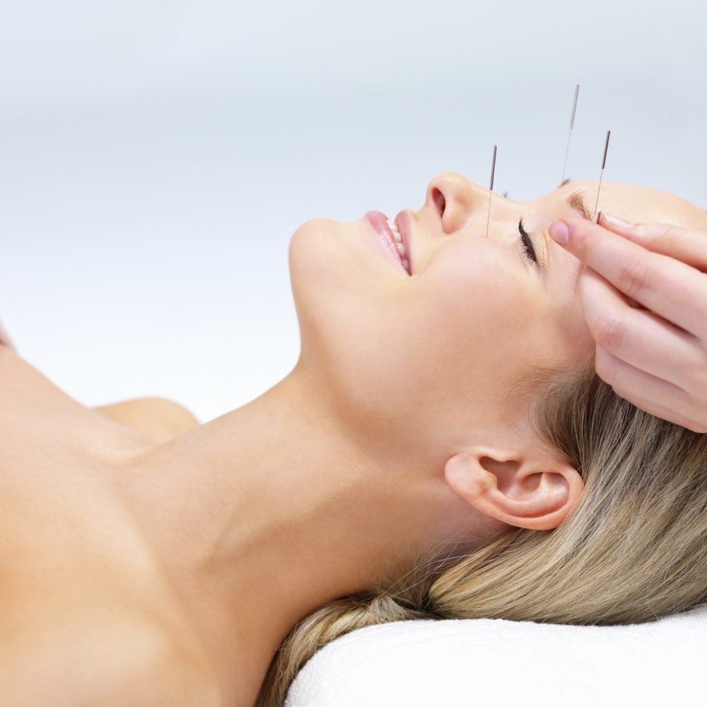 Cosmetic Acupuncture - Shine Health Wellbeing Centre